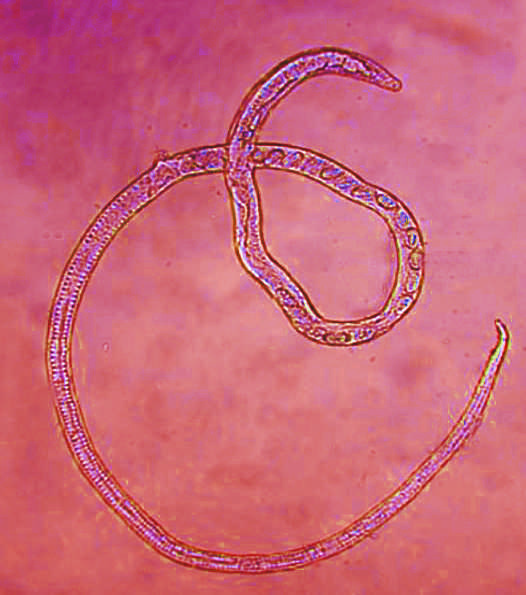 Capillaria Hepatica - ENCYKLOPEDIA PASOŻYTÓW