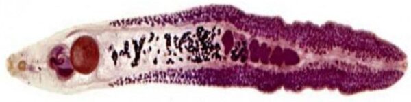 Echinostoma Revolutum - Echinostomiasis - ENCYKLOPEDIA PASOŻYTÓW