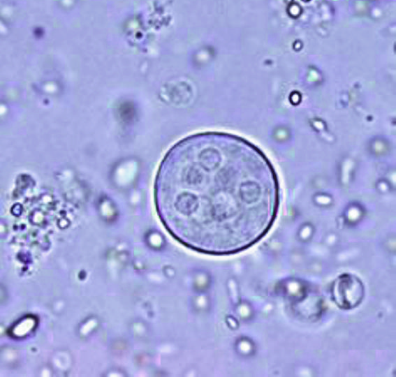 Entamoeba Coli - ENCYKLOPEDIA PASOŻYTÓW