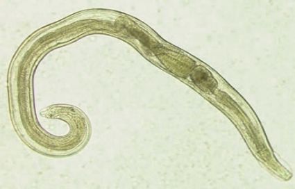 Owsik Ludzki - ENCYKLOPEDIA PASOŻYTÓW