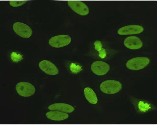 Crithidia - ENCYKLOPEDIA PASOŻYTÓW